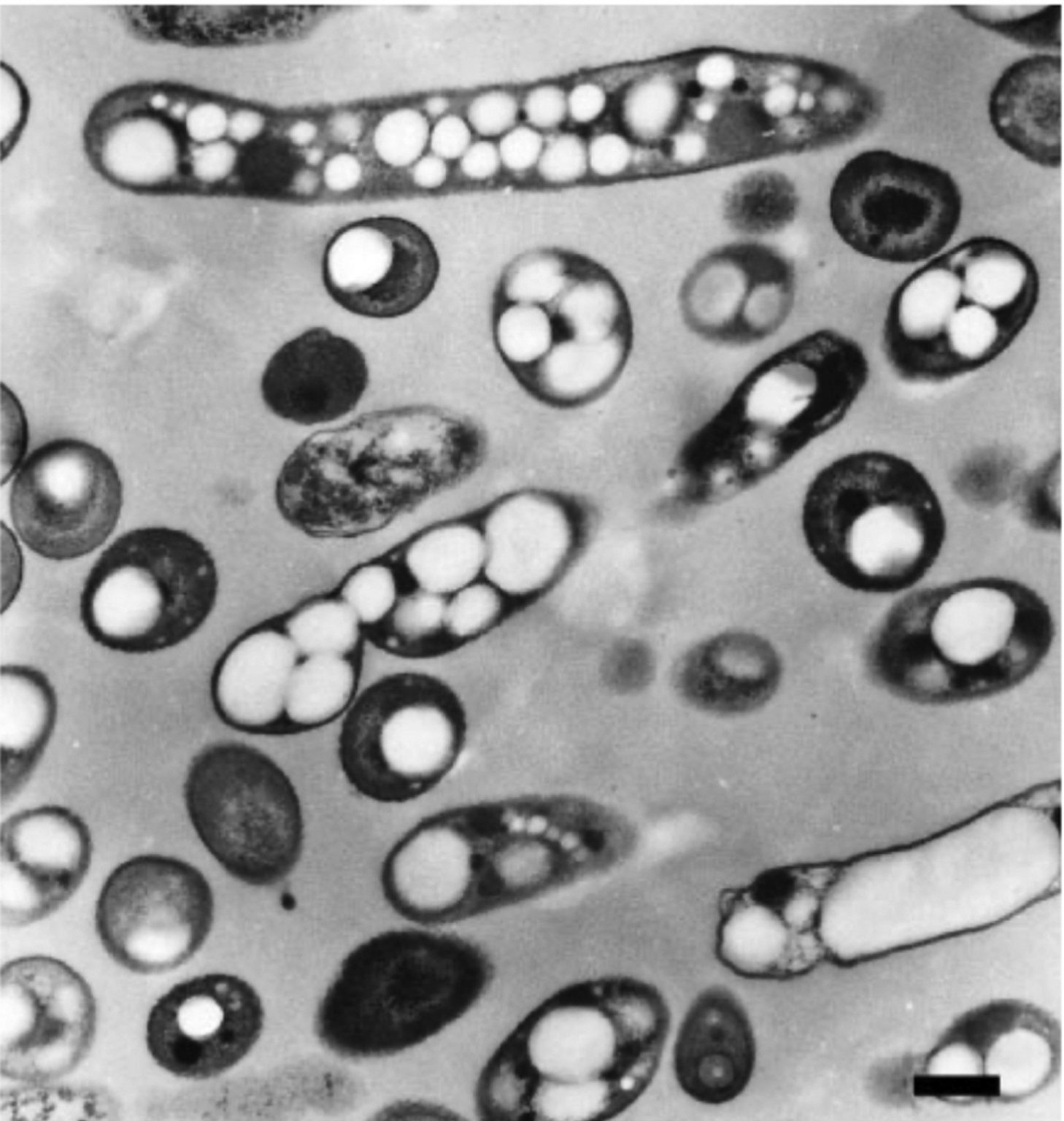 Polihidroxibutirato Sintasa (PhaC), ¿el nuevo salvavidas ecológico ...